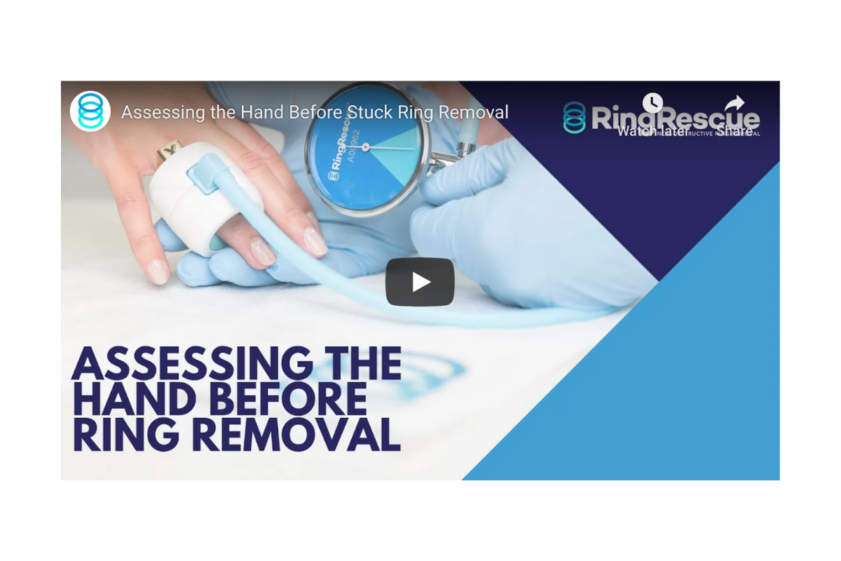 Hand Assessment — Ring Rescue - Stuck Ring Removal Solutions